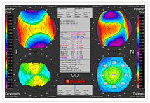 Orbscan & Zywave Aberrometry | ISEC Malaysia