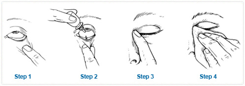 How to insert Eye Drops? - INTERNATIONAL SPECIALIST EYE CENTRE MALAYSIA